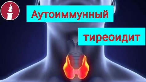 Аутоиммунный тиреоидит Power Matrix Youtube