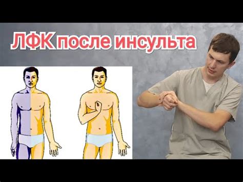 Упражнения для руки после инсульта - ЛФК при инсульте, парезе - YouTube