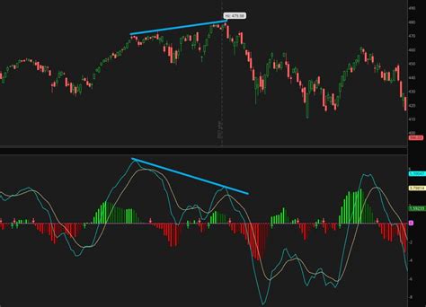 Macd Indicator For Thinkorswim A Complete Breakdown