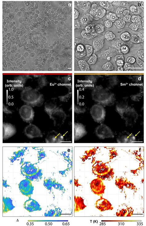 Figure 1 From Real Time Intracellular Temperature Imaging Using Lanthanide Bearing Polymeric