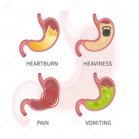 Dizzy Nausea Heartburn At Mitzi Mcclain Blog