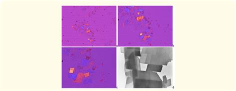 A 5d 1119 2007 Unstained Synovial Fluid Wet Preparation Download Scientific Diagram