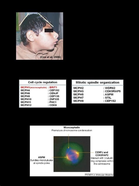 Human Microcephaly Results From A Null Mutation In One Of 12 Identified Download Scientific