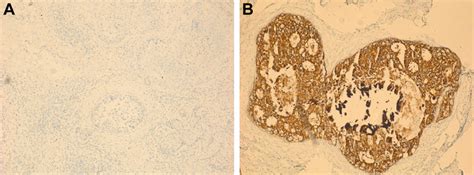 The Immunohistochemistry Of Bmp 2 ×200 Notes A Negative Bmp 2