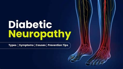 Diabetic Neuropathy Types Symptoms Causes Prevention Tips Diabetes