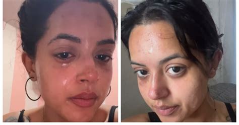 Abigail Hija De Lupillo Rivera Sufre Lesiones Tras Explosión De Estufa “mi Papá Es Lo último