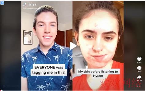 Tiktok Duet功能如何用？tiktok运营进阶技巧 Tiktok账号购买平台