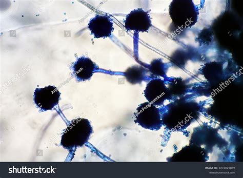 Microscope Black Fungus Spore Strain Lactophenol Stock Photo 2272029869 Shutterstock
