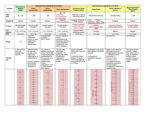Heart Rhythm Chart