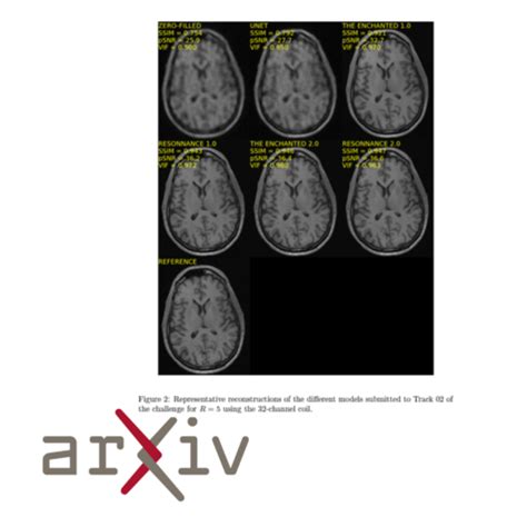 Multi Coil Mri Reconstruction Challenge — Assessing Brain Mri