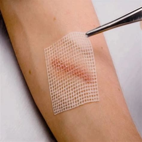 Chlorhexidine Gauze Dressing Size 10 X 10cm 10 X 30cm At Best Price