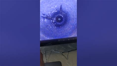 How Spendle Looks Inside Microscopic View Of Spendlevalve Set Youtube