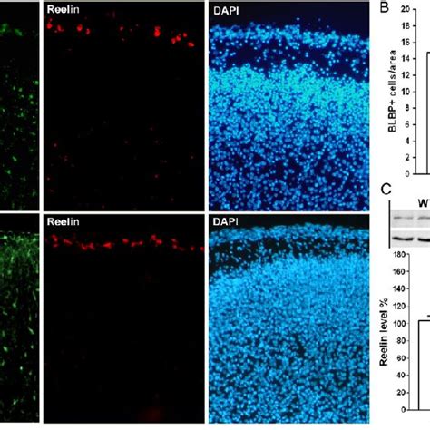 Increase In Ctip2 Layer Thickness In P2 P50 − − Mice Cortex Upper Download Scientific Diagram