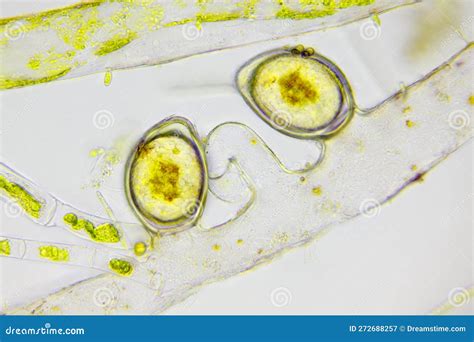 Microscopic View Of Freshwater Algae Filament At Propagation Stage