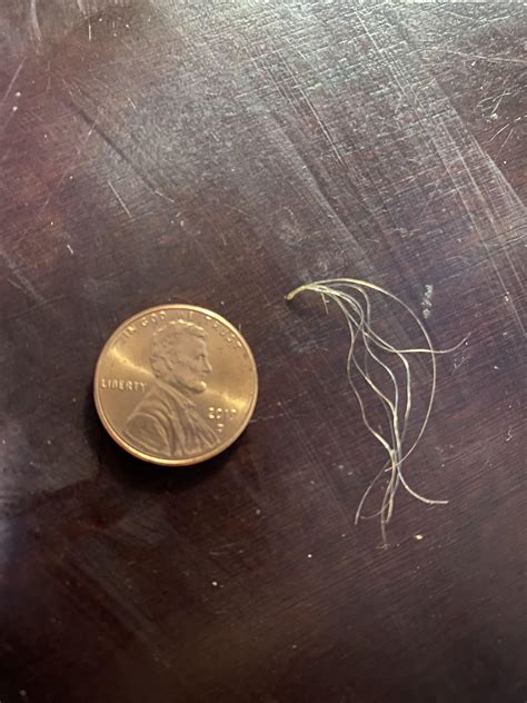 Pili Multigemini I Found In The Beard Today Rpopping