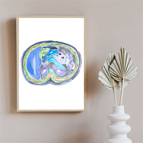 Abdominal Ct Scan Cross Section Radiology Gastroenterology And Surgery Medpapers