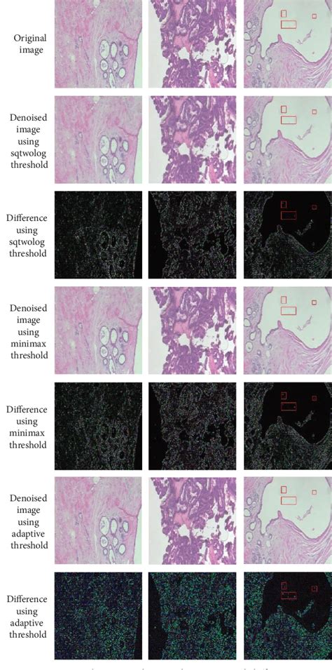 Figure 1 From Adaptive Threshold Learning In Frequency Domain For Classification Of Breast