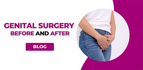 Things One Should Consider Before And After Genital Surgery