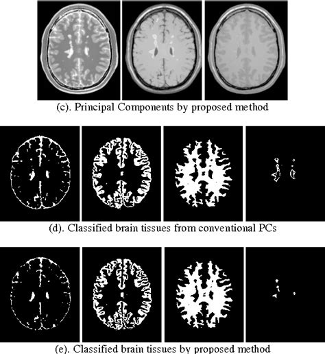 Figure 4 From Brain Tissue Classification From Multispectral Mri By Wavelet Based Principal