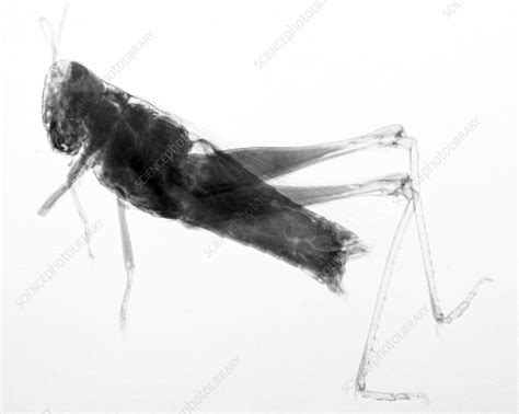 Grasshopper X Ray Stock Image C0270098 Science Photo Library