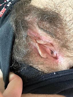 Wild Hairy Vulva