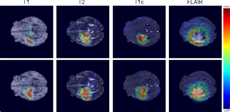 figure 1 from weakly supervised segmentation with cross modality equivariant constraints