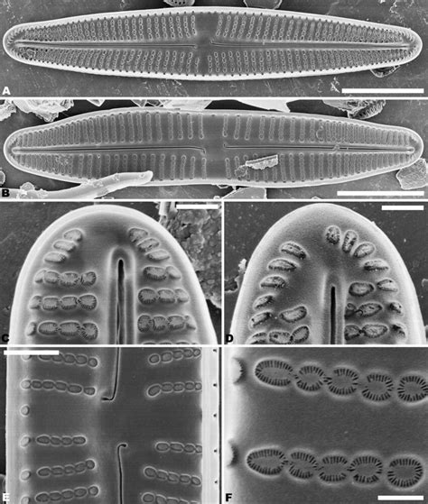 Afachnanthidium Anhuense Sp Nov Sem Internal Views Of Raphe Valve