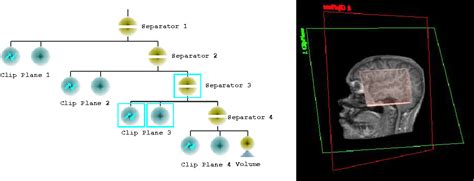 Figure 2 From Intuitive And Interactive Manipulation Of 3d Data Sets By Integrating Texture
