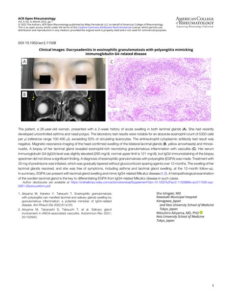 Pdf Clinical Images Dacryoadenitis In Eosinophilic Granulomatosis