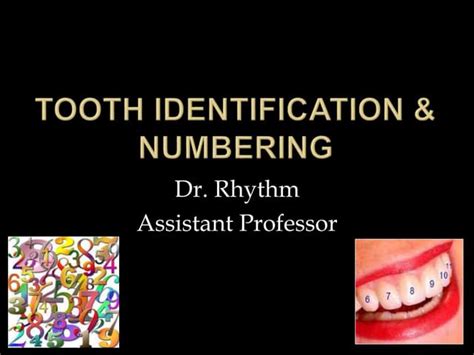 Bds Ii Year Lecture Tooth Notationpptx