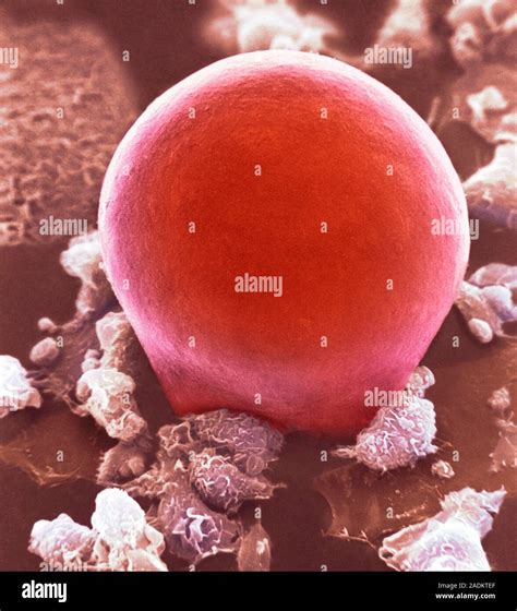 Fat Cell Coloured Scanning Electron Micrograph Sem Of An Adipocyte Fat Cell Red
