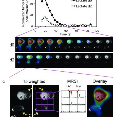 13 C Mrsi Of The Metabolism Of Hyperpolarized Pyruvate Indicating Download Scientific Diagram