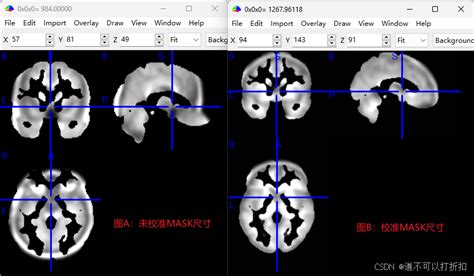 如何用掩模（mask提取mri图像的原理与技术掩膜提取 Csdn博客