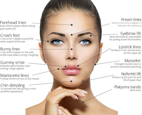 Anti-wrinkle Injections