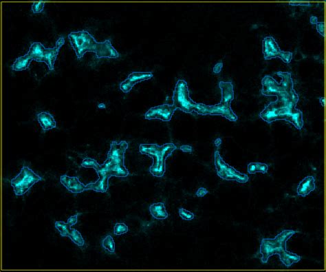 Macrophage Segmentation Image Analysis Image Sc Forum