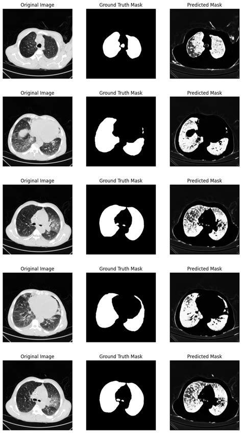 Iti Ai Deeplearning Imagesegmentation Unet Computervision Python