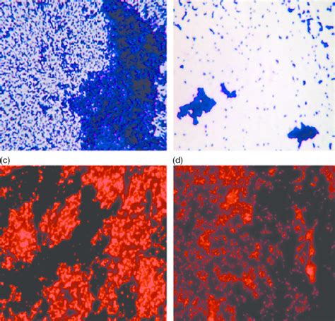 Light Microscopy Of Acinetobacter Baumannii A3 Cells Attached To A Download Scientific