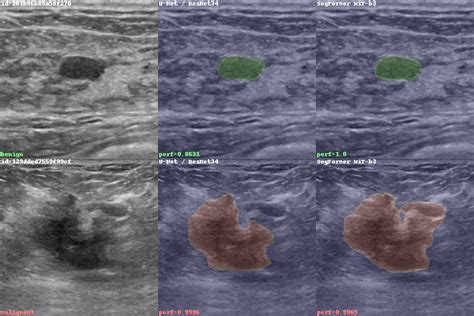 Github Florinandreidatasciencecapstoneproject My Data Science Masters Degree Capstone