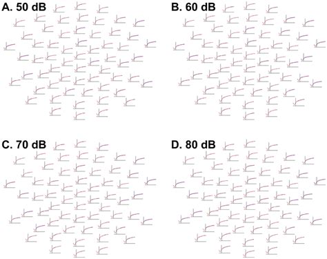 Waveforms At Each Electrode Depicting Separately In Each Intensity
