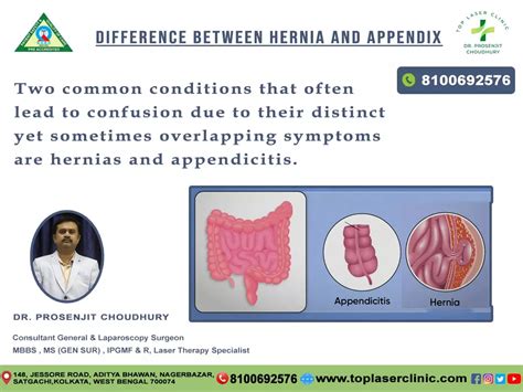 Understanding The Variances Hernia Vs Appendicitis Deciphering