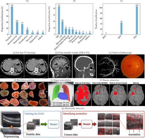 Description Programming Languages Similar Projects Of Data Augmentation Review Gitplanet