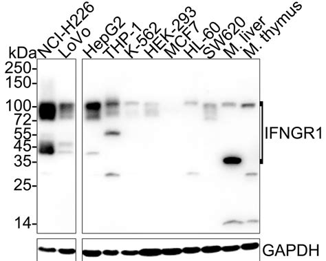 Ifngr1 Recombinant Rabbit Monoclonal Antibody Je40 50 Ha721952 Huabio