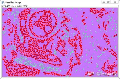 Imagej实用技巧——免疫组化分析 定量分析篇 知乎