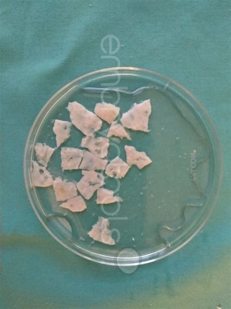 06 Ovarian Tissue Cryopreservation Embryotools