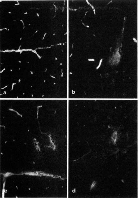 Normal Vessel Permeability And Various Grades Of Vessel Permeability Download Scientific