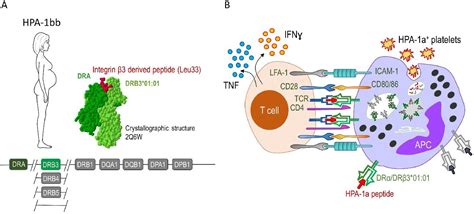 foetal and neonatal alloimmune thrombocytopenia the role of the hla drb3 01 01 allele for hpa
