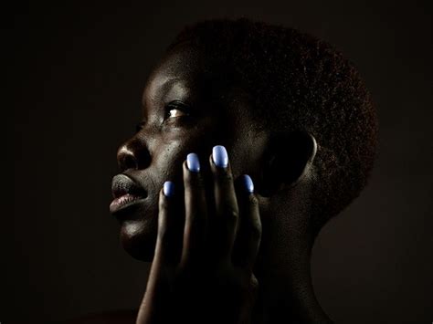 What Causes Shingles To Activate Possible Triggers And More