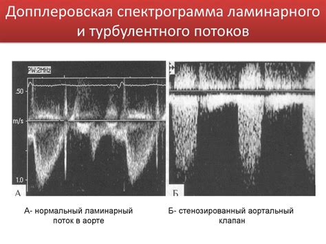 Ультразвуковые диагностические приборы презентация онлайн