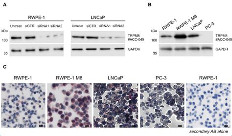 Trpm8 Protein Expression In Hormone Naïve Local And Lymph Node