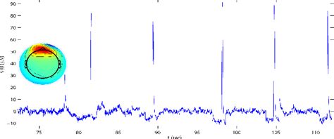 Figure 1 From A Generalized Multivariate Logistic Model And Em Algorithm Based On The Normal